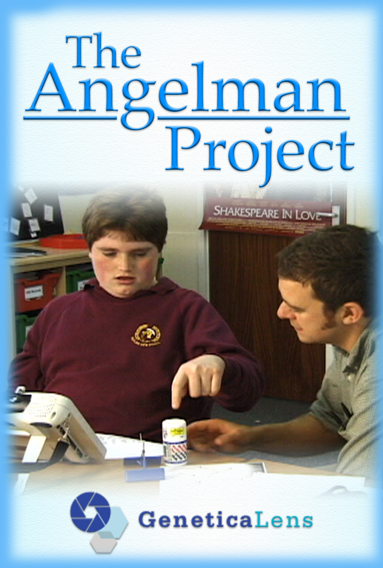 Therapies for Angelman Syndrome – The Angelman Project
